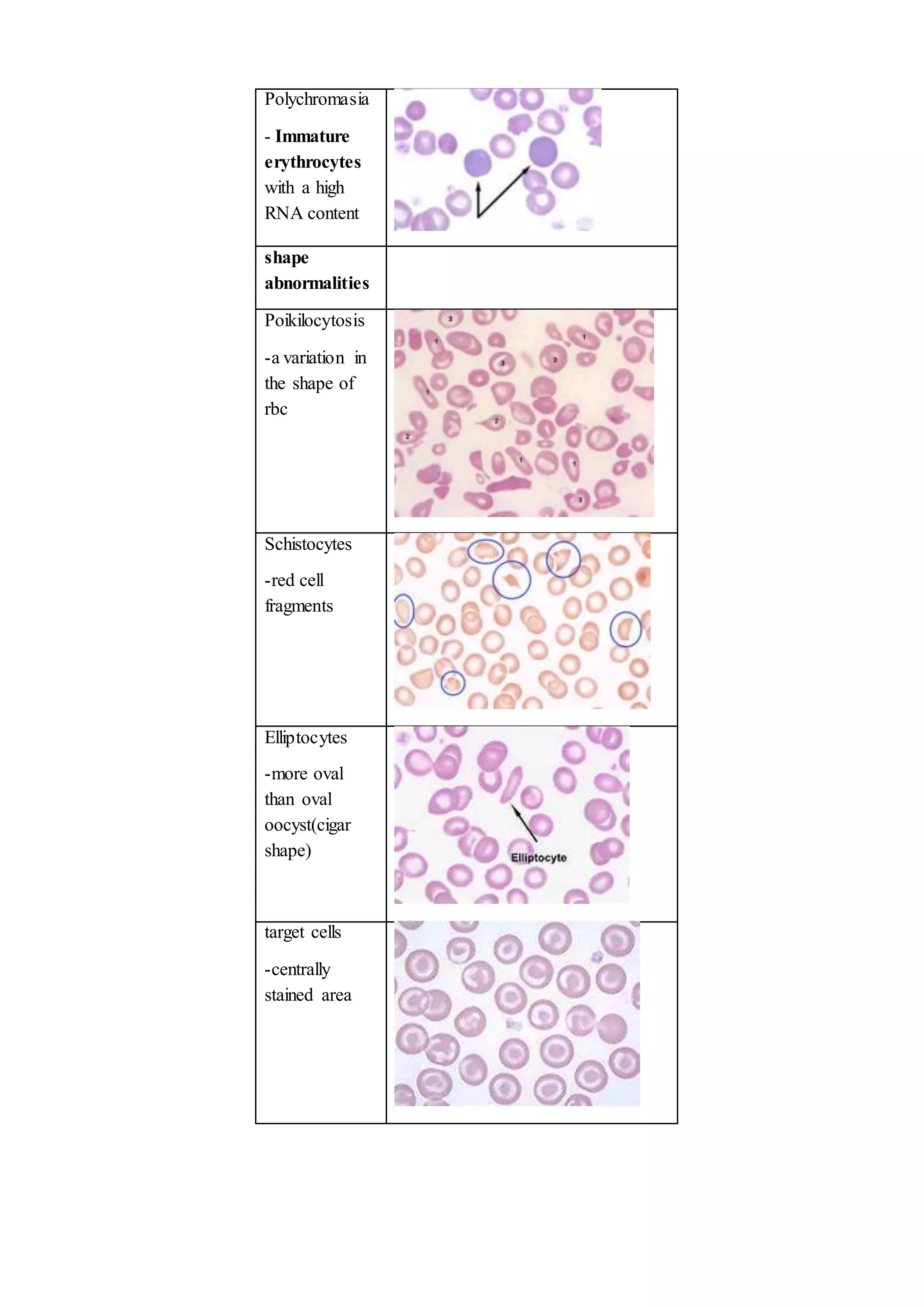 H007 identify normal and abnormal erythrocyte, platelet and leucocytes ...