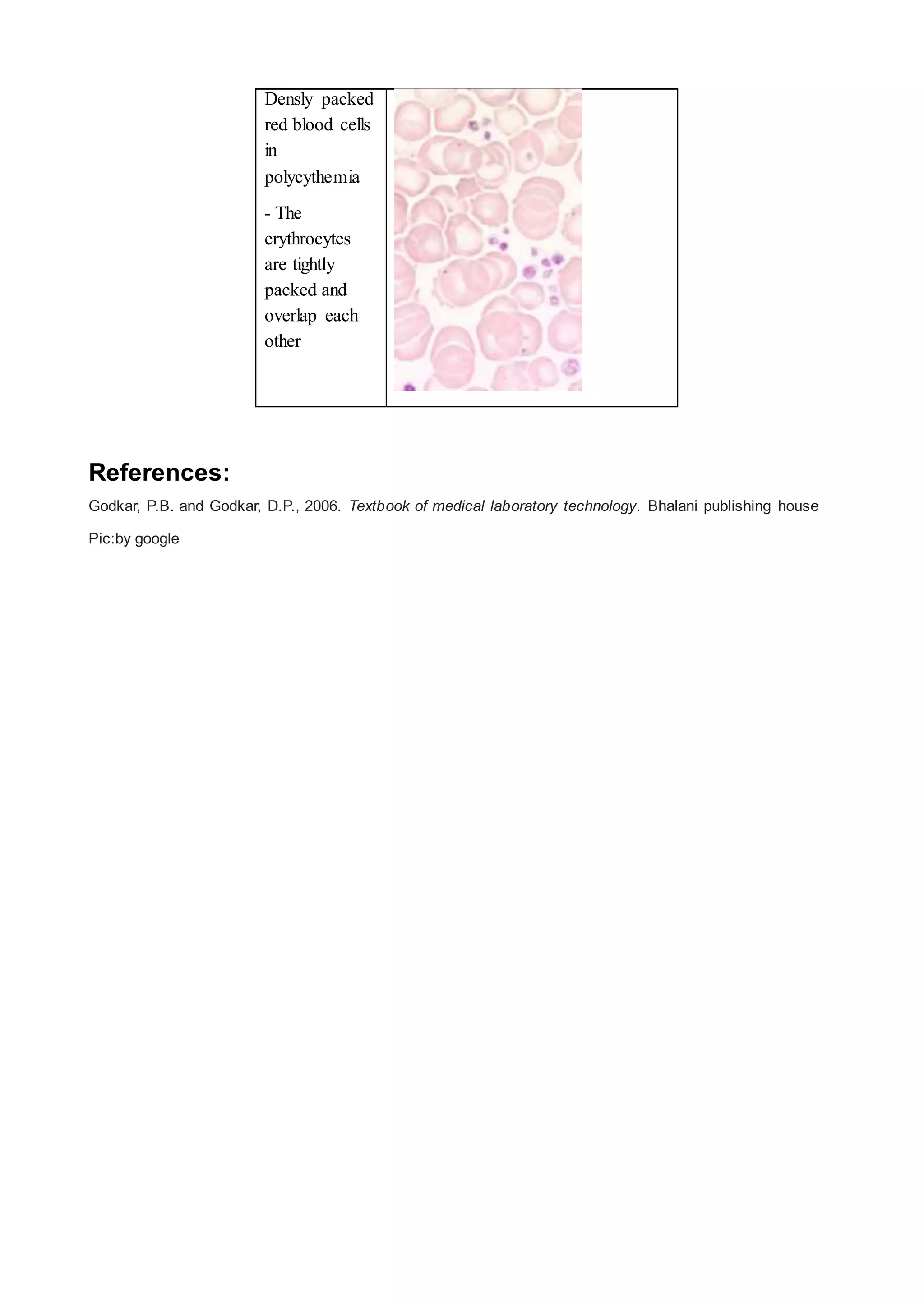 H007 identify normal and abnormal erythrocyte, platelet and leucocytes ...