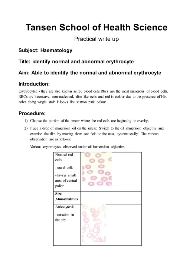 H007 identify normal and abnormal erythrocyte, platelet and leucocytes ...