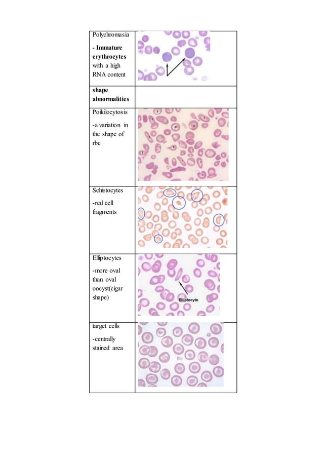 H007 identify normal and abnormal erythrocyte, platelet and leucocytes ...