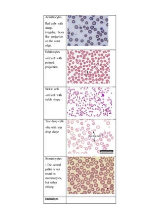 H007 identify normal and abnormal erythrocyte, platelet and leucocytes ...