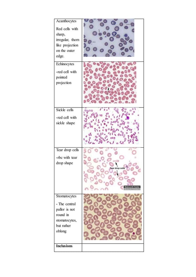 H007 identify normal and abnormal erythrocyte, platelet and leucocytes ...