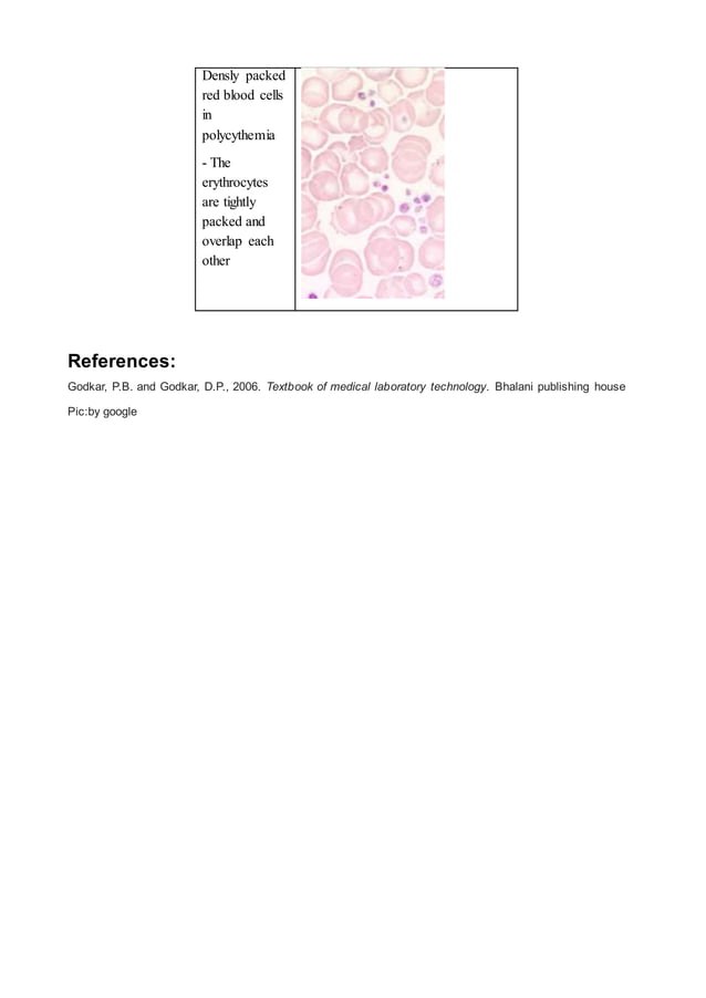 H007 identify normal and abnormal erythrocyte, platelet and leucocytes ...