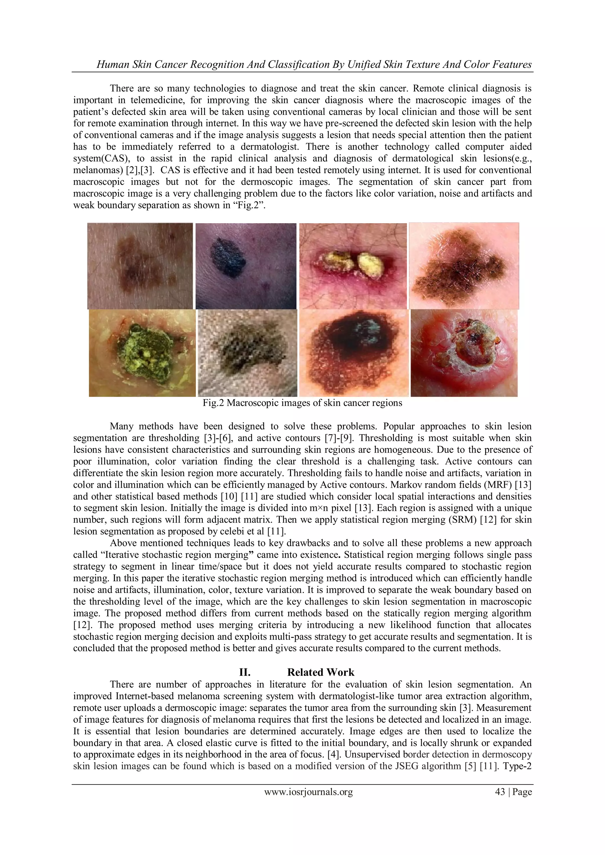 Human Skin Cancer Recognition and Classification by Unified Skin ...