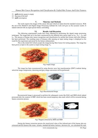 Human Skin Cancer Recognition and Classification by Unified Skin ...