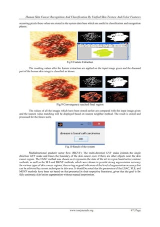 Human Skin Cancer Recognition and Classification by Unified Skin ...
