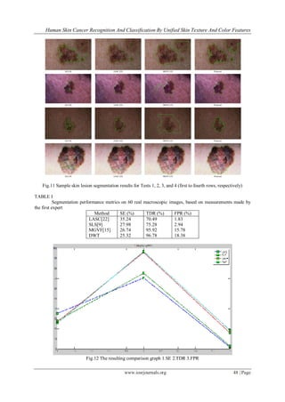 Human Skin Cancer Recognition and Classification by Unified Skin ...