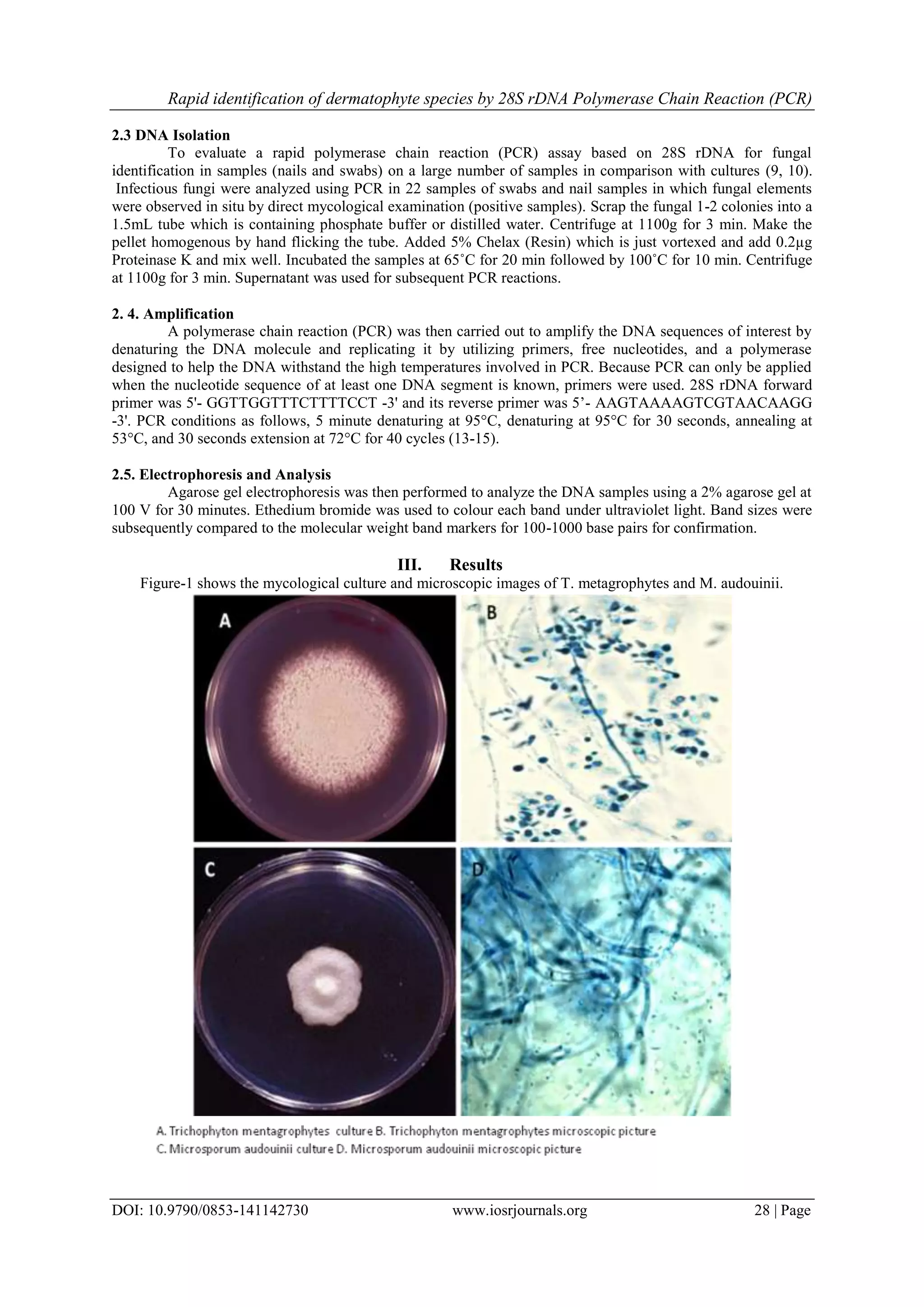Rapid identification of dermatophyte species by 28S rDNA Polymerase ...