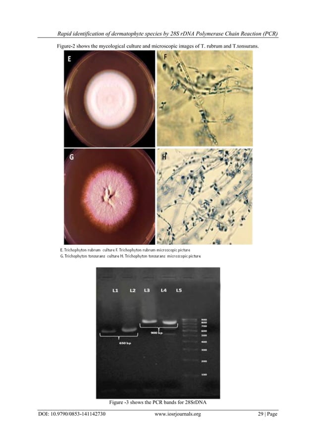 Rapid identification of dermatophyte species by 28S rDNA Polymerase ...