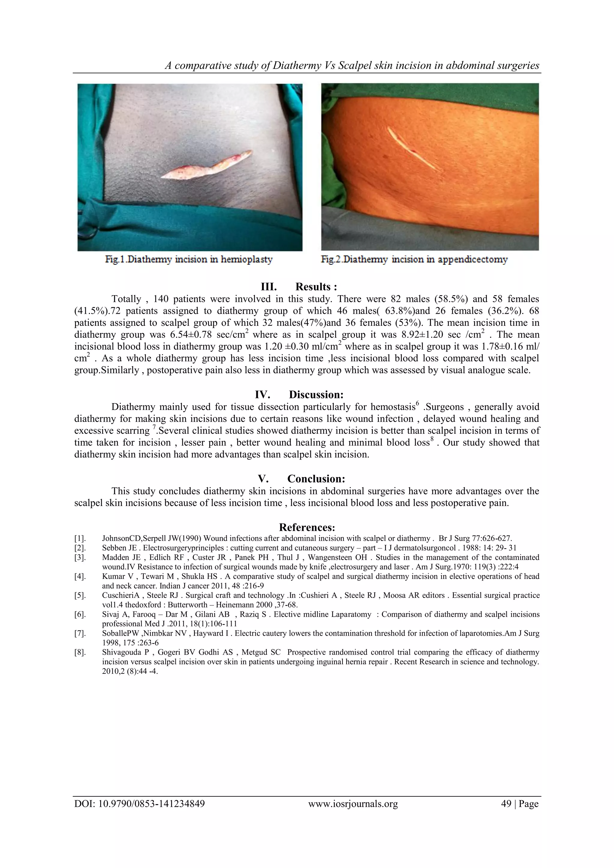 A comparative study of Diathermy Vs Scalpel skin incision in abdominal ...