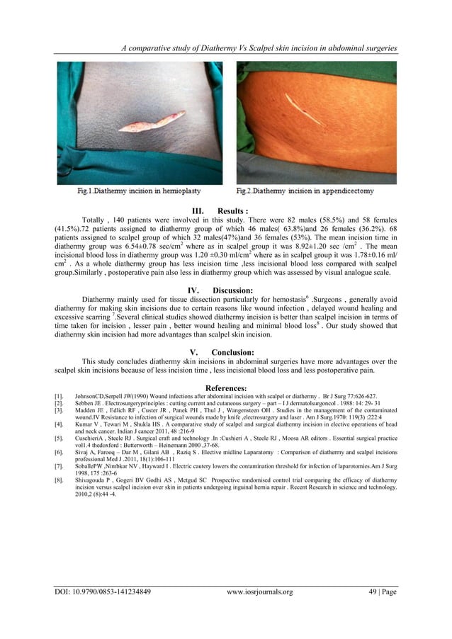 A comparative study of Diathermy Vs Scalpel skin incision in abdominal ...