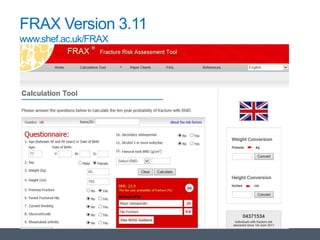 Osteoporosis 2016 | Fracture Risk assessment tools: Prof. Eugene ...