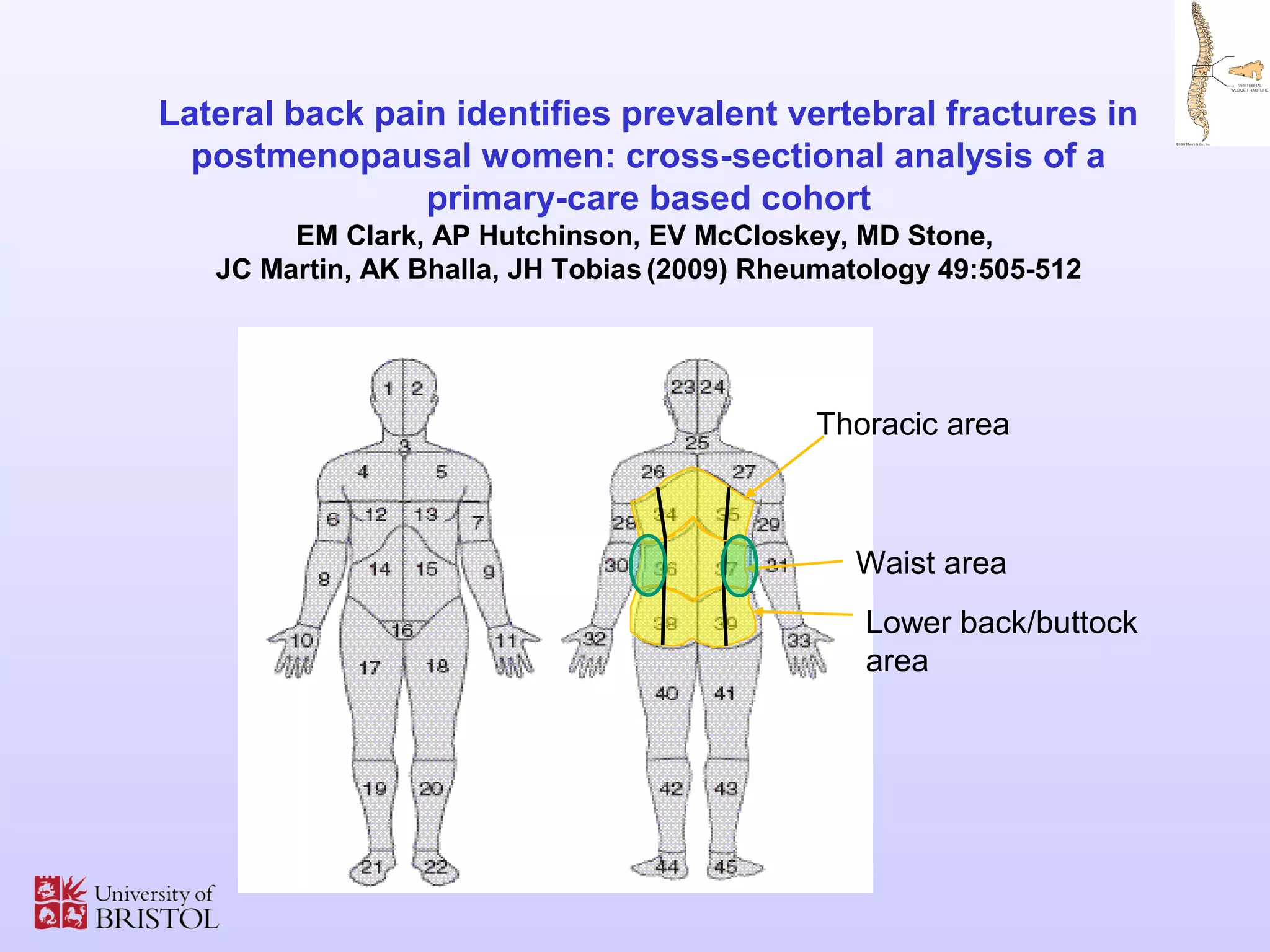 Osteoporosis 2016 | Fracture Risk Assessment: Vertebral fractures: Dr ...