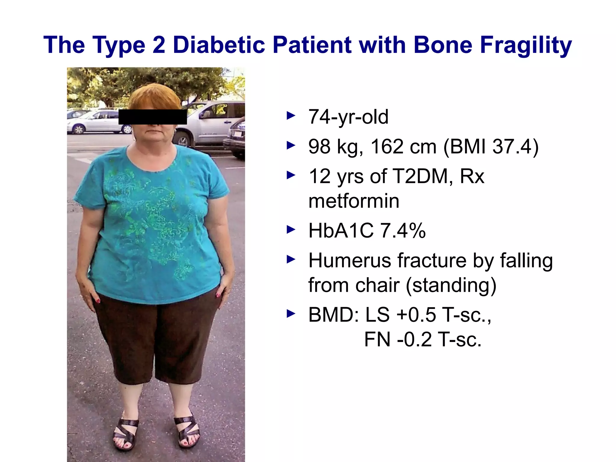 Osteoporosis 2016 | Diabetes and bone: Prof. Serge Ferrari #osteo2016 | PPT