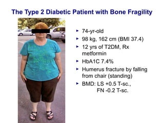 Osteoporosis 2016 | Diabetes and bone: Prof. Serge Ferrari #osteo2016 | PPT