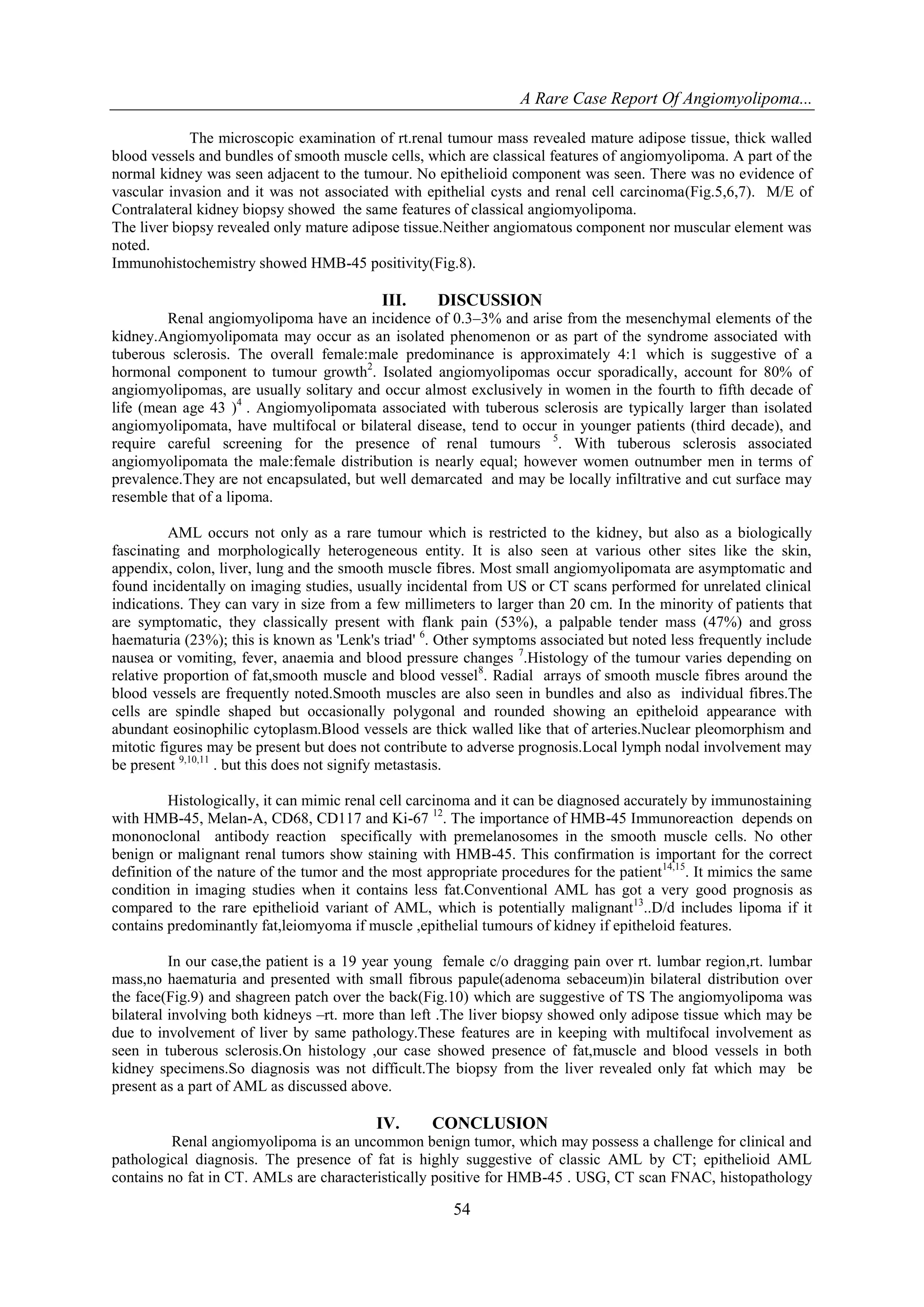 A Rare Case Report of Angiomyolipoma Kidney Associated with Tuberous ...