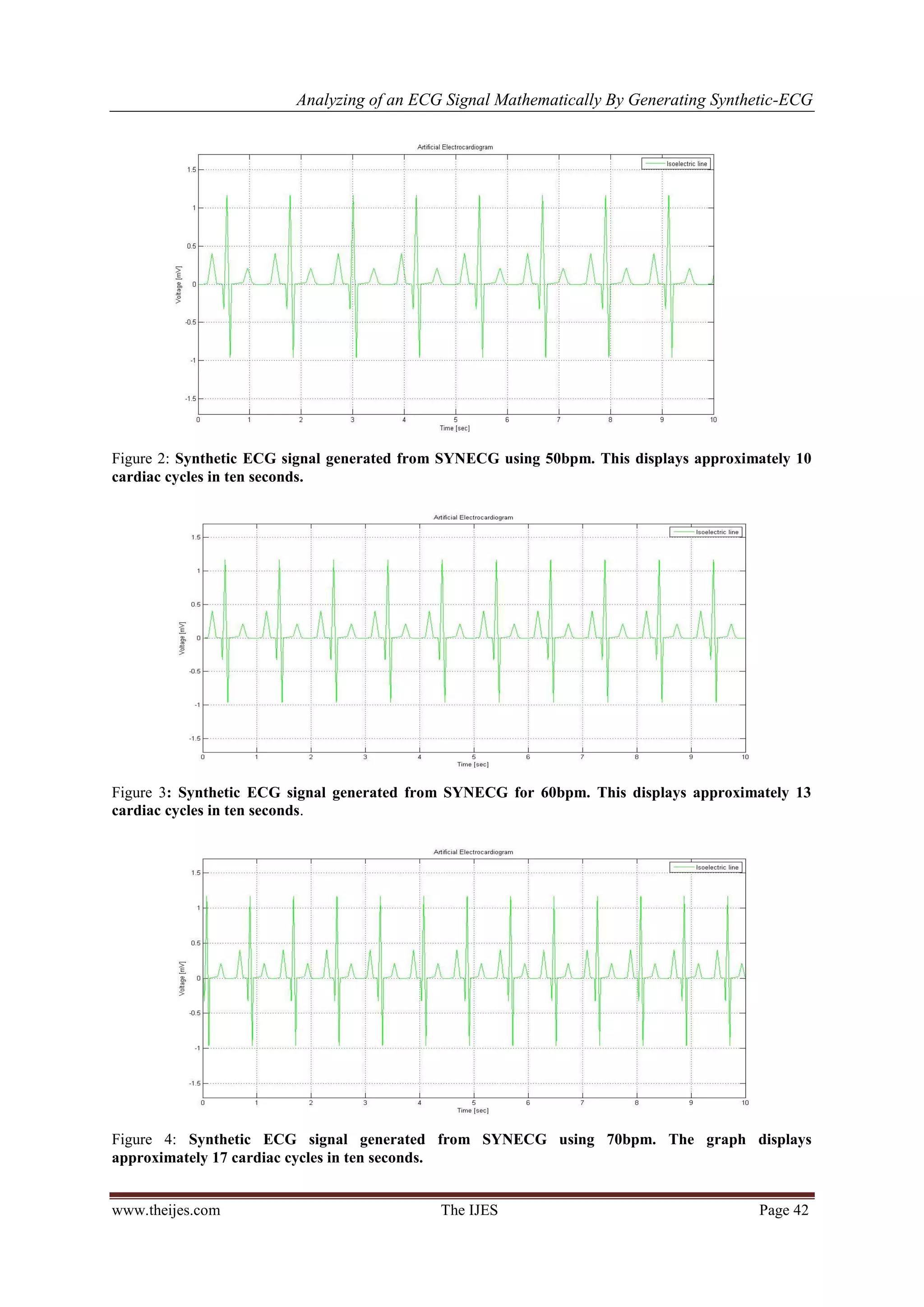 Analyzing of an ECG Signal Mathematically By Generating Synthetic-ECG | PDF