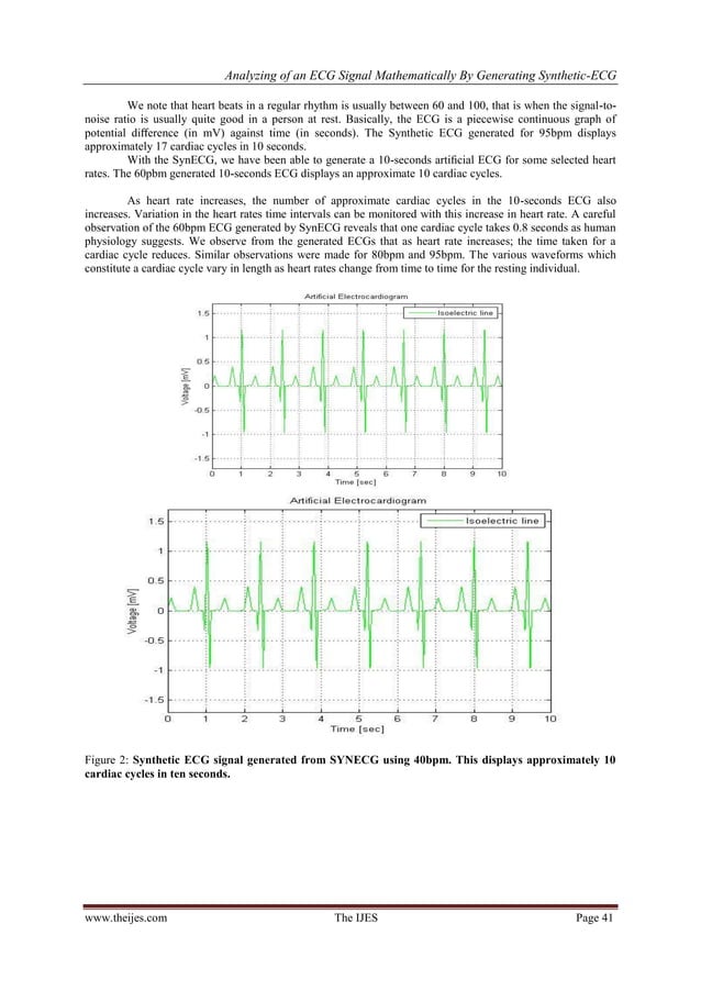 Analyzing of an ECG Signal Mathematically By Generating Synthetic-ECG | PDF