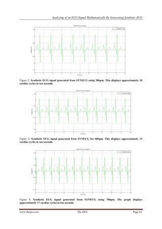 Analyzing of an ECG Signal Mathematically By Generating Synthetic-ECG | PDF