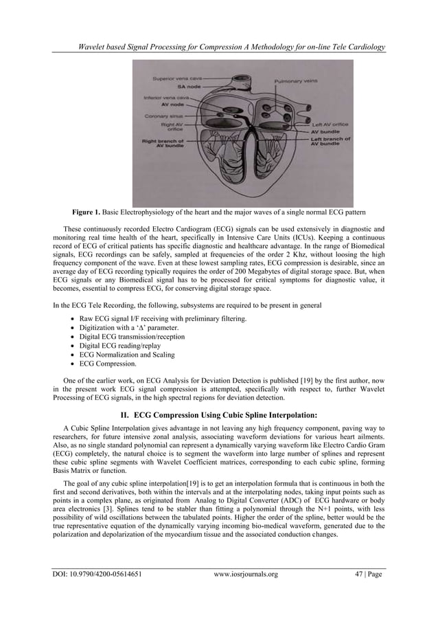 Wavelet based Signal Processing for Compression a Methodology for on-line Tele Cardiology | PDF