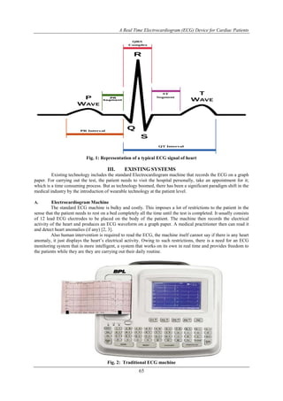 A Real Time Electrocardiogram (ECG) Device for Cardiac Patients | PDF