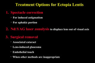 26 ectopia lentis | PPT