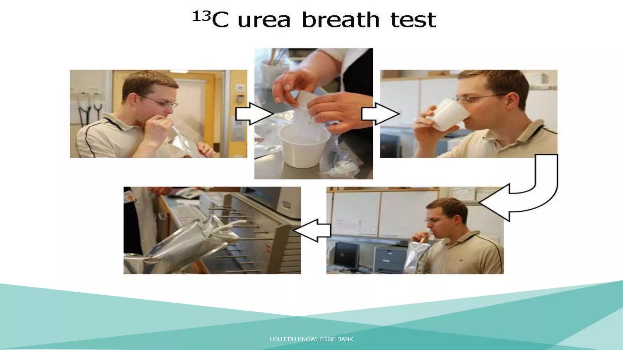 Effect of H2R blocker on Urea breath test | PPTX