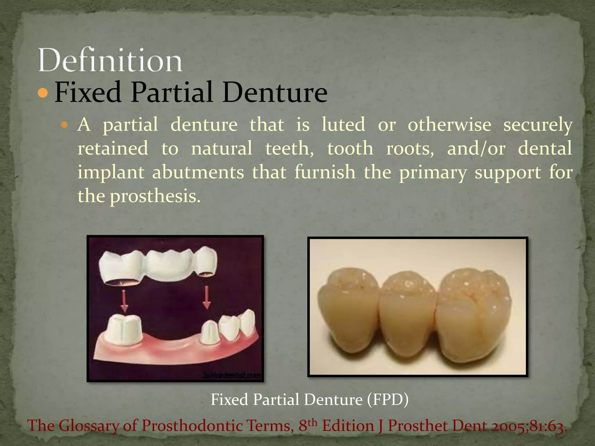 Periodontally Compromised Dentiition | PPTX