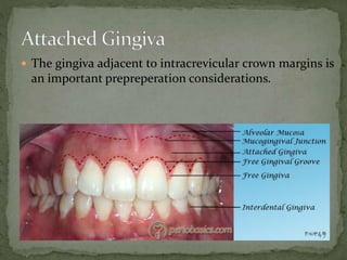 Periodontally Compromised Dentiition | PPTX