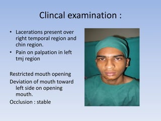 condylar_fracture_Anas_shoaib.ppt