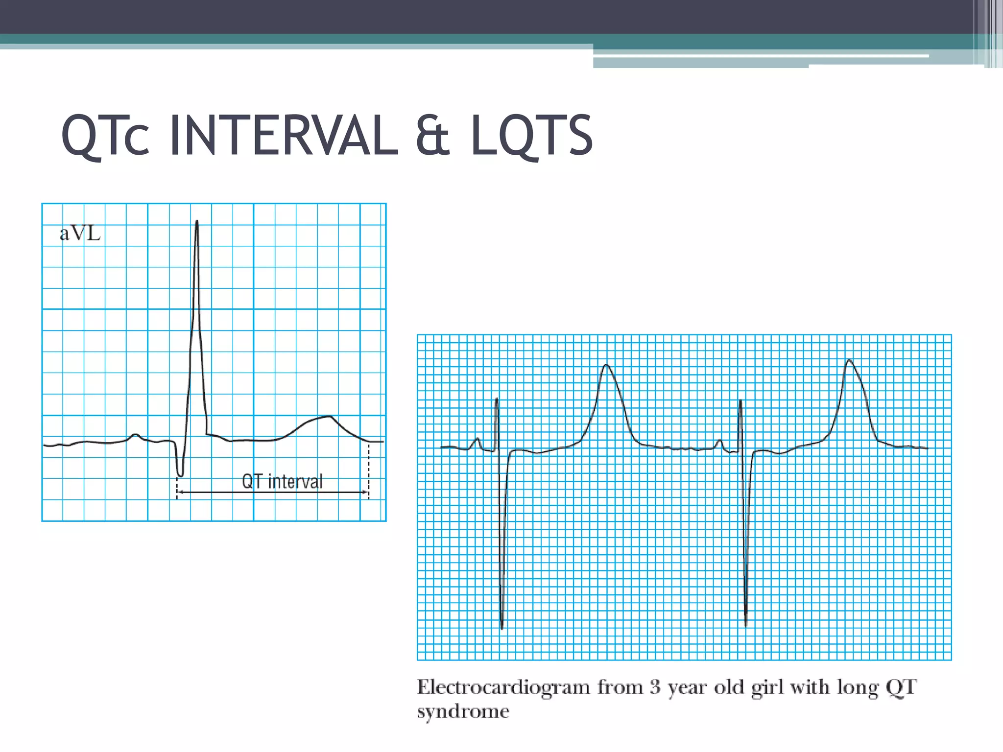 Pediatric ECG final.pptx