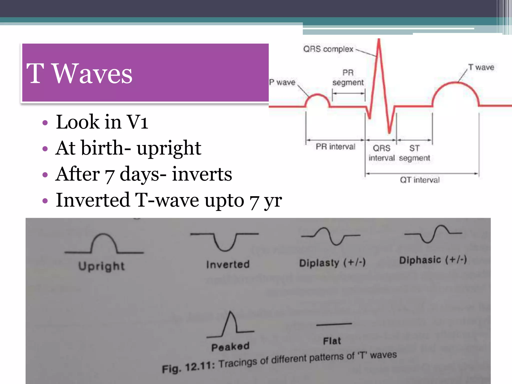 Pediatric ECG final.pptx