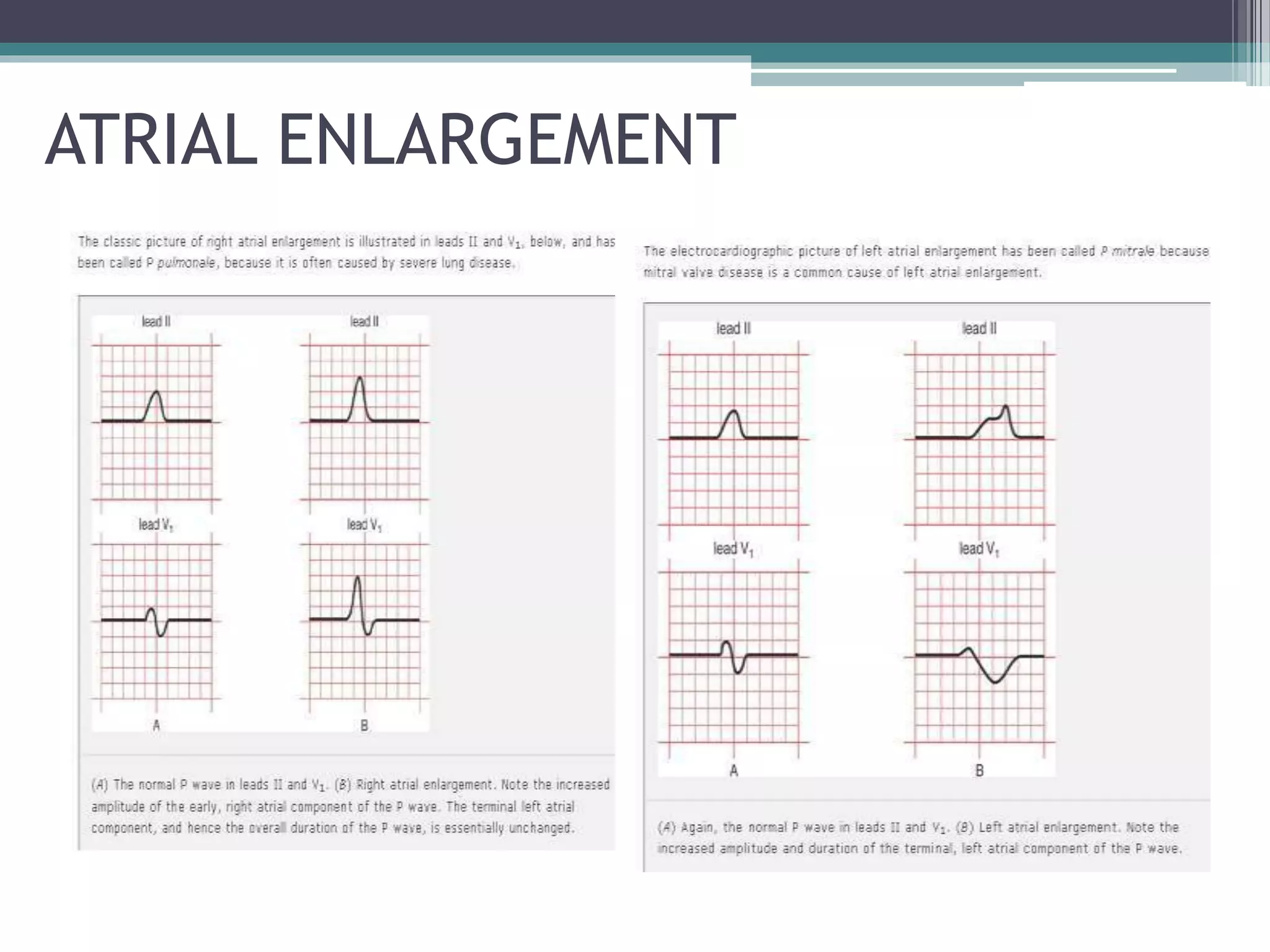 Pediatric ECG final.pptx
