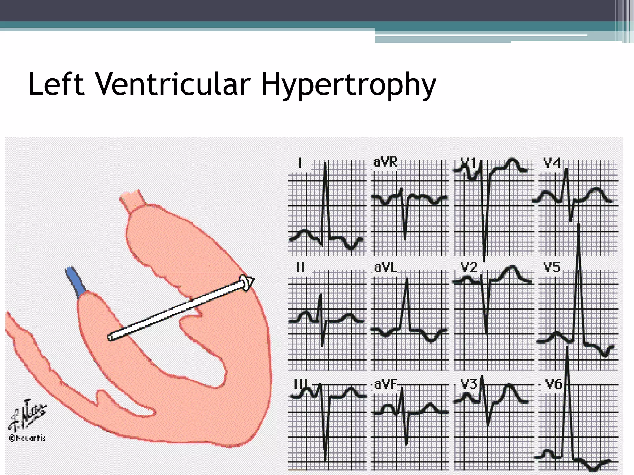 Pediatric ECG final.pptx