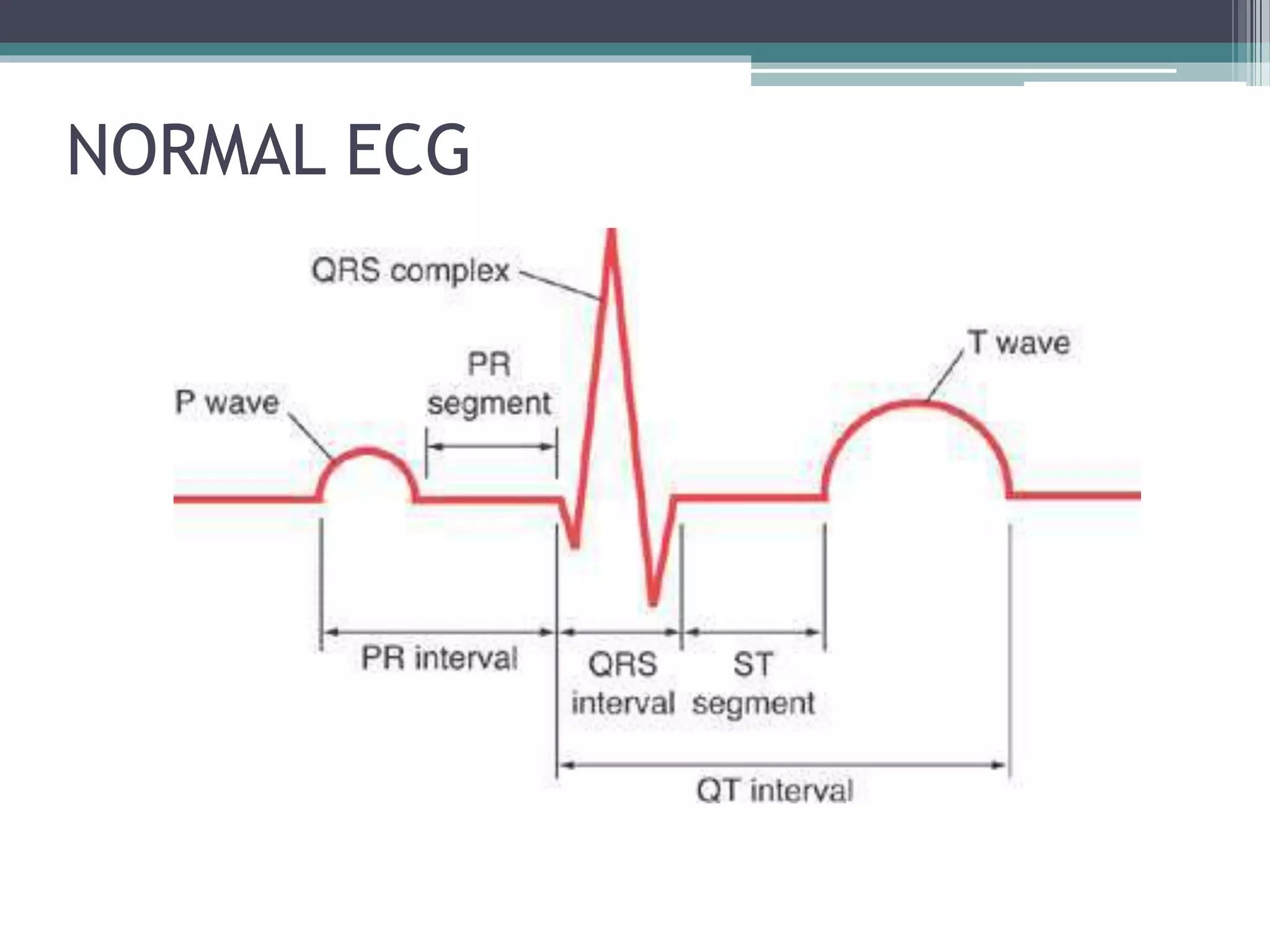 Pediatric ECG final.pptx