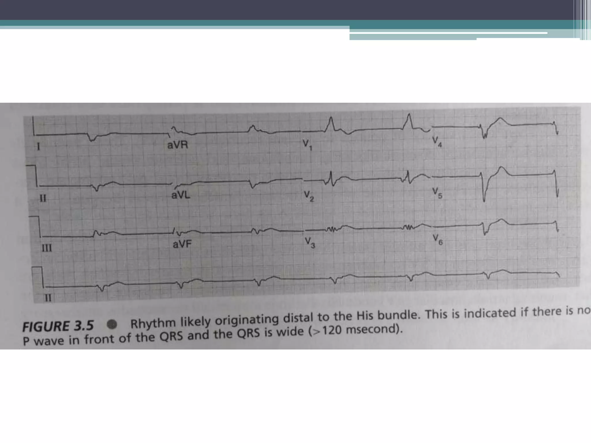 Pediatric ECG final.pptx