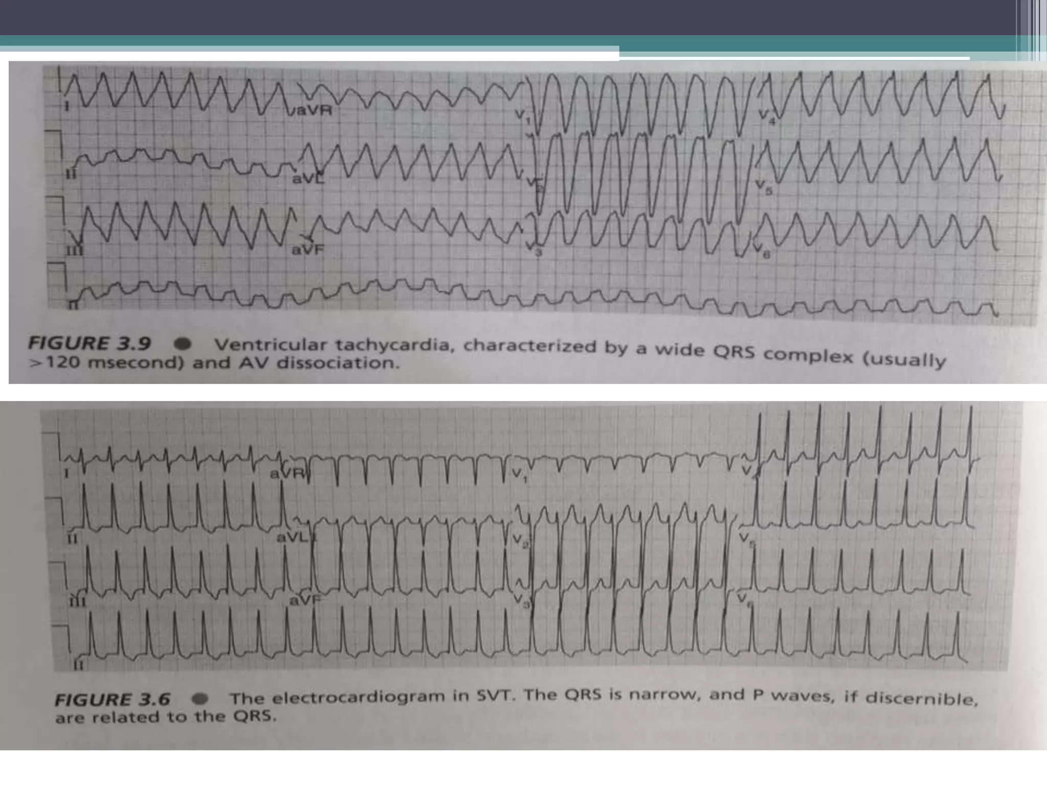 Pediatric ECG final.pptx