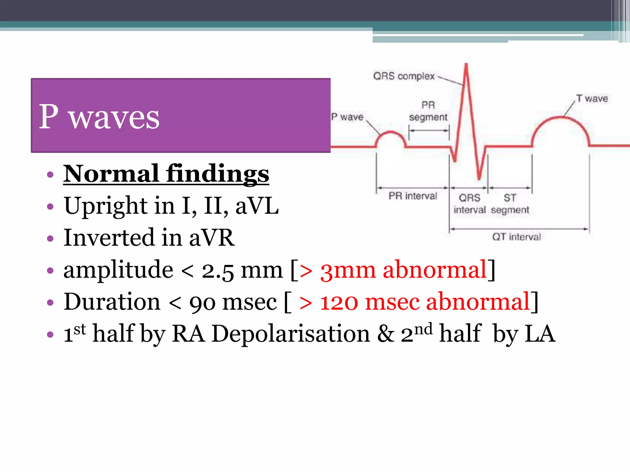 Pediatric ECG final.pptx