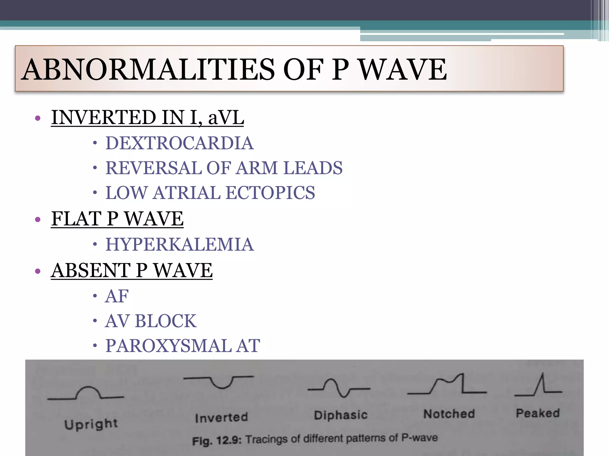 Pediatric ECG final.pptx