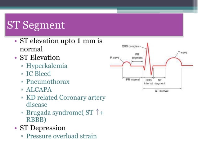 Pediatric ECG final.pptx