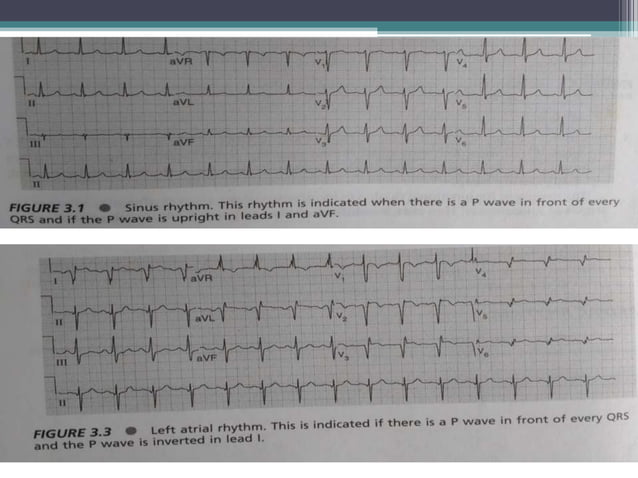 Pediatric ECG final.pptx