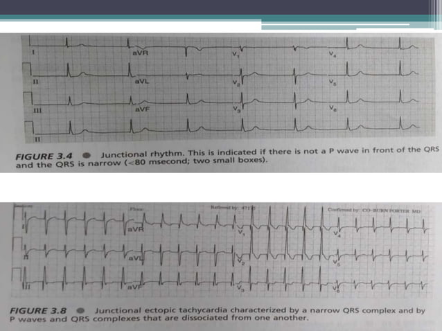 Pediatric ECG final.pptx