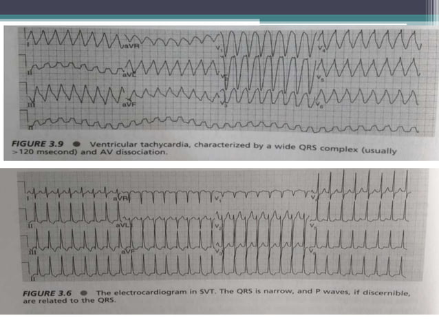 Pediatric ECG final.pptx