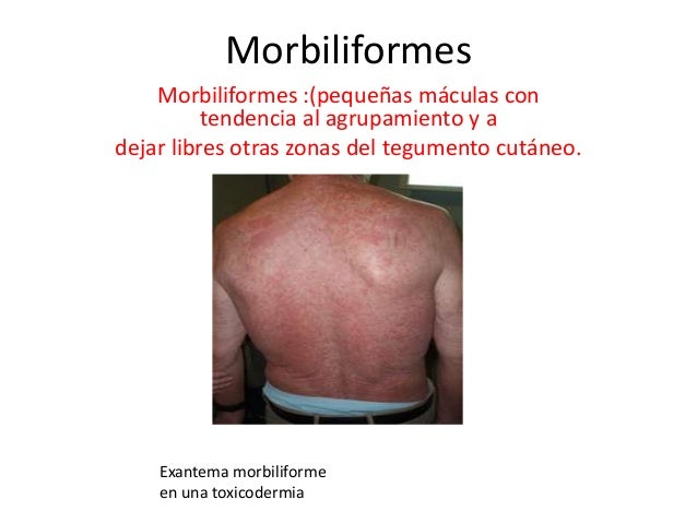 Habilidades semana 3