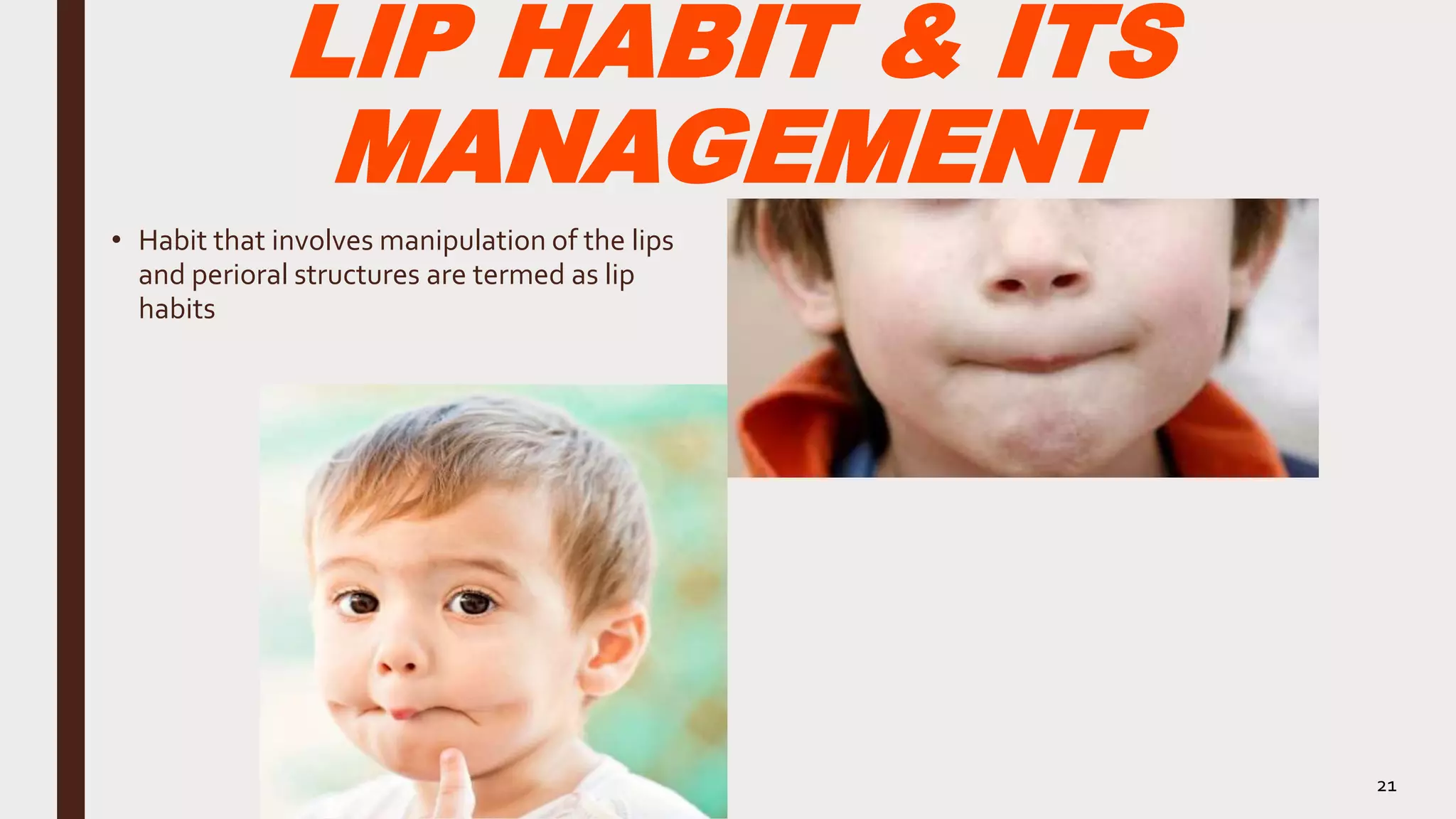 Habit breaking appliances | PPTX