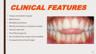 Habit breaking appliances | PPTX