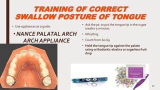 Habit breaking appliances | PPT | Free Download