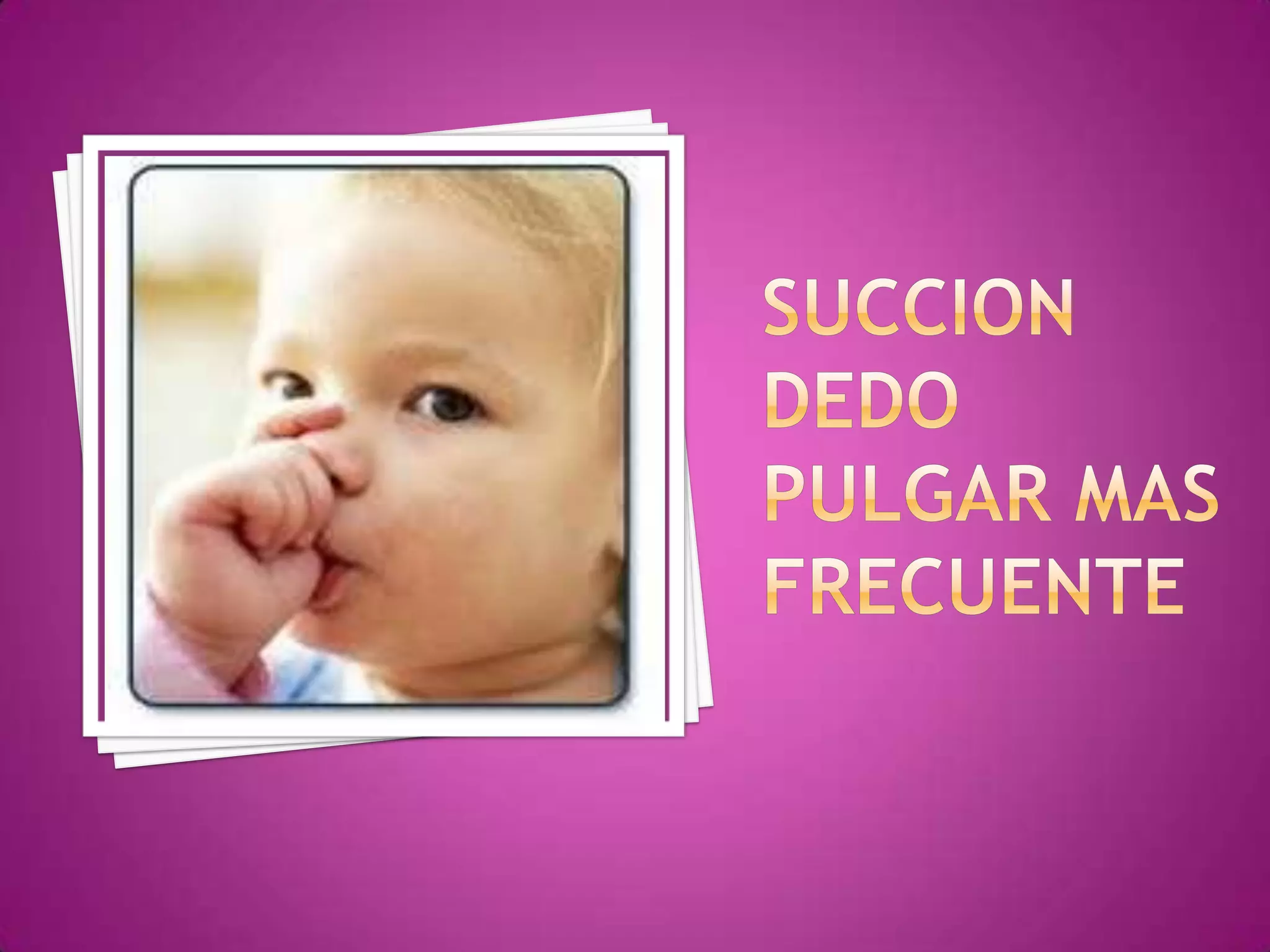 Habito de succión digital | PPTX
