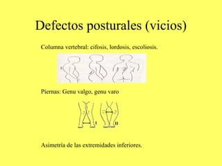 Habitos posturales | PPT