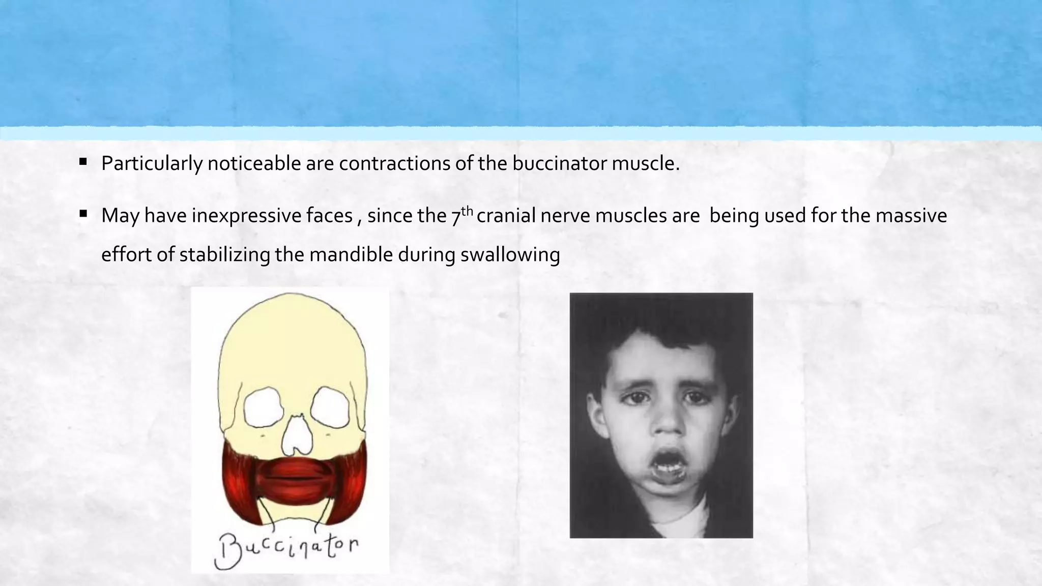 Oral Habits in Children. Part II: Tongue thrusting,Mouth Breathing,Frenum thrusting,Cheek biting ...